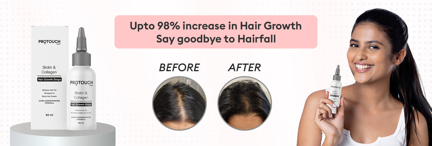 Boost Hair Growth with Ultra Concentrated Serum With 6 Actives – Protouch
